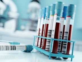 Blood Tests Show Promise in Early Detection of Alzheimer’s Disease ...